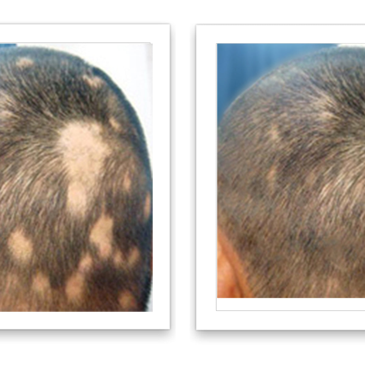 Caboki 10X Hair Powder Trial Size – Caboki.com